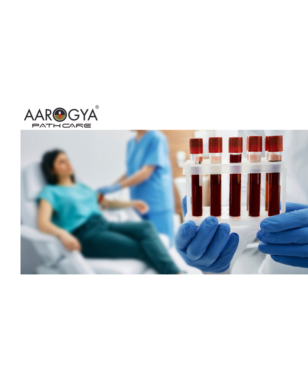 Aarogya Pathcare: Full Body Checkup 89 Test @ 999/- Book Now